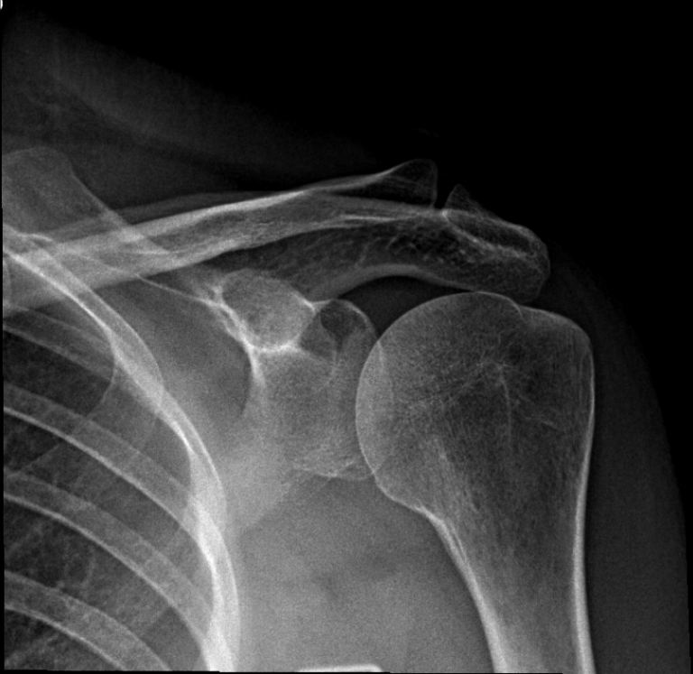 X-ray of upper-extremity joints | 1,200,000 Studies - unidata.pro