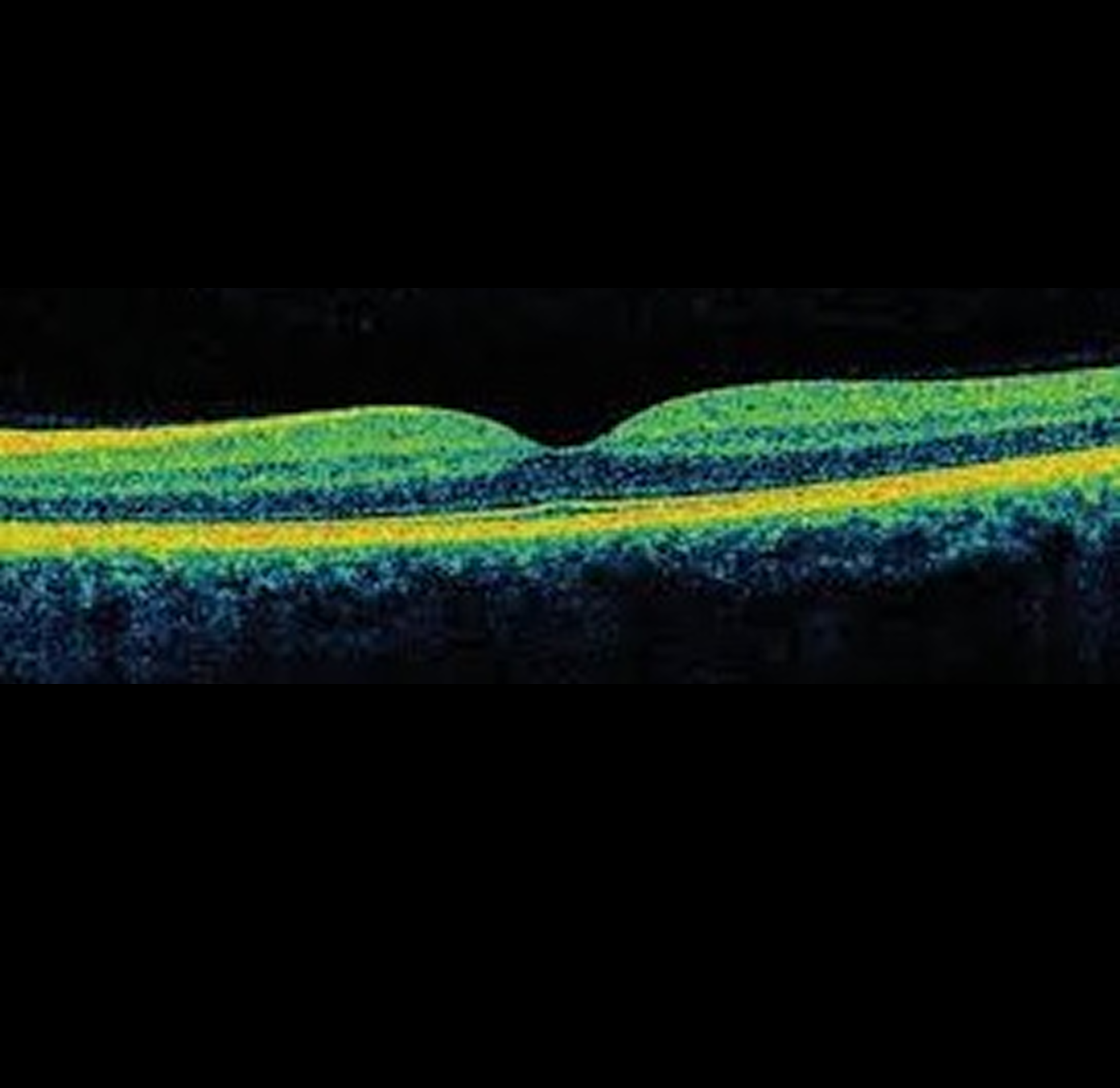 Oct Retinal Dataset Unidata Pro