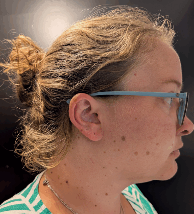 Facial Skin Condition Dataset Unidata Pro